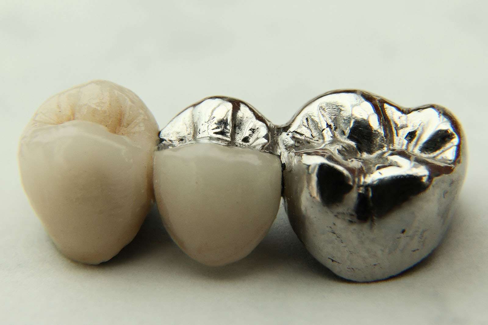 Refaire Ses Dents : Les 10 Techniques Expliquées Par Le Dr. Zisserman